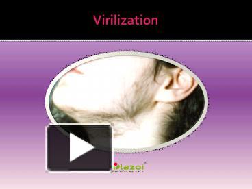 Virilization: A common female health condition (2) presentation | free ...