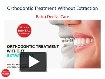 PPT – Orthodontic Treatment Without Extraction PowerPoint presentation ...