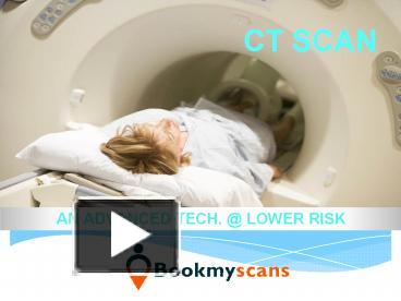 CT Scan Cost presentation | free to download