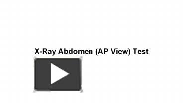 X ray abdomen (ap view) test presentation | free to download