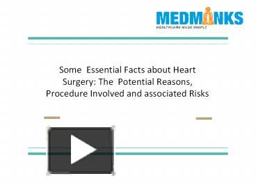 PPT – Some Essential Facts about Heart Surgery PowerPoint presentation ...