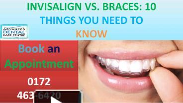 Teeth Braces for Adults presentation | free to download