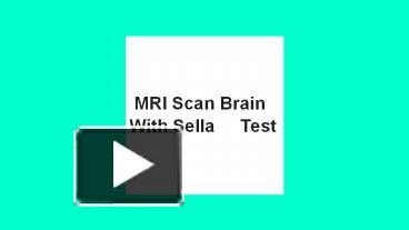 Mri scan brain with sella test presentation | free to download