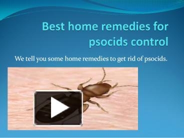 PPT – BEST HOME REMEDIES FOR PSOCIDS CONTROL PowerPoint presentation ...