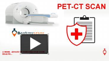 PPT – What is PET-CT Scan?? Get a detailed overview & Checkout the real ...