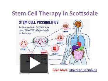Stem Cell Therapy presentation | free to download