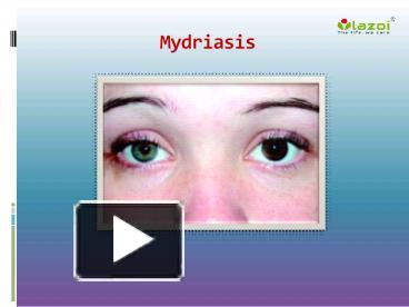 Mydriasis: Causes, Symptoms, Daignosis, Prevention and Treatment ...