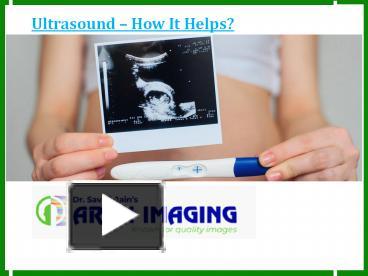 Ultrasound – How It Helps? presentation | free to download