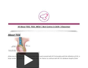All About TESE, TESA, MESA | Best Centres in Delhi | Elawoman ...