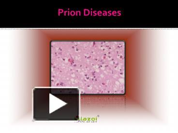 PPT – Prion Disease: Causes, Symptoms, Daignosis, Prevention and ...