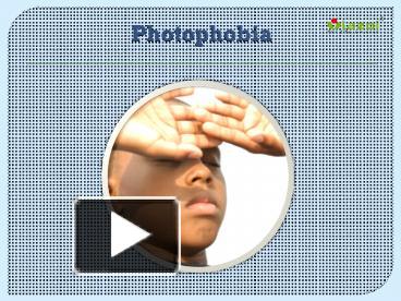 Photophobia: Causes, Symptoms, Daignosis, Prevention and Treatment ...