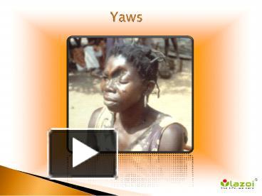 Yaws: Causes, Symptoms, Daignosis, Prevention and Treatment ...