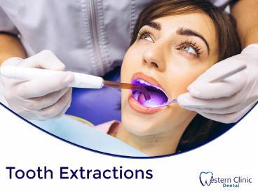 Western Clinic Dental - Tooth Extraction presentation | free to download