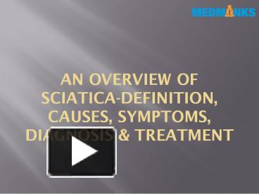 AN OVERVIEW OF SCIATICA-DEFINITION, CAUSES, SYMPTOMS, DIAGNOSIS ...