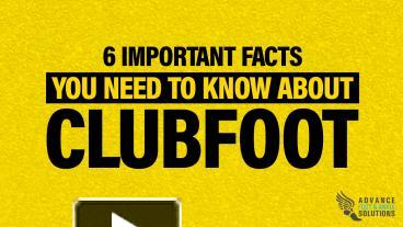 6 Important Facts You Need To Know About Clubfoot presentation | free ...