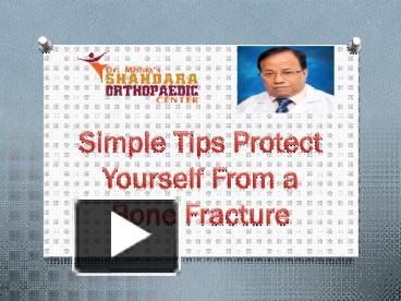 PPT – Simple Tips Protect Yourself From a Bone Fracture PowerPoint ...