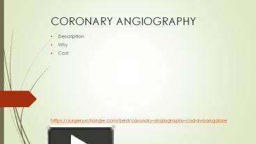 Coronary Angiography presentation | free to download