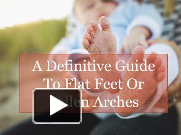 A Definitive Guide To Flat Feet Or Fallen Arches presentation | free to ...