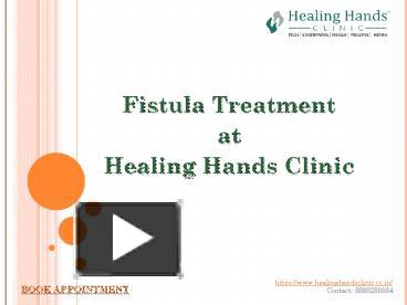 Fistula Treatment at Healing Hands Clinic (1) presentation | free to ...