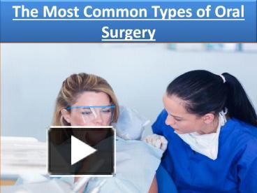 PPT – The Most Common Types of Oral Surgery PowerPoint presentation ...