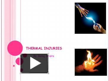 THERMAL INJURY presentation | free to view