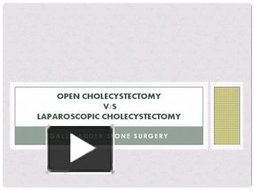 PPT – Open Cholecystectomy v/s Laparoscopic cholecystectomy ...