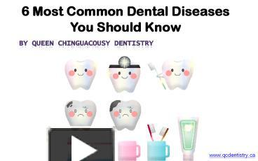 6 Most Common Dental Diseases You Should Know presentation | free to ...