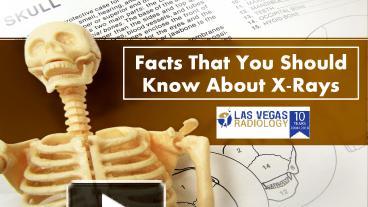 Facts That You Should Know About X-Rays presentation | free to download