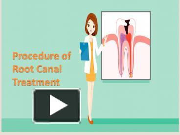 PPT – Root Canal Treatment Process PowerPoint presentation | free to ...