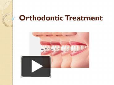 PPT – Orthodontic Treatment PowerPoint presentation | free to download ...