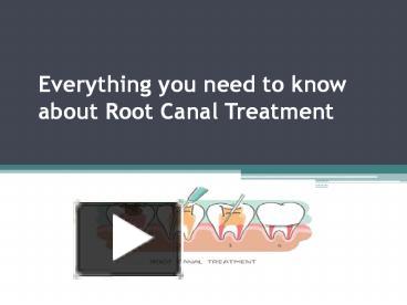 PPT – Everything you need to know about Root Canal Treatment PowerPoint ...