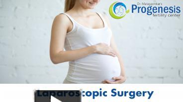 PPT – Laparoscopic Surgery PowerPoint presentation | free to download ...
