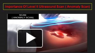Importance Of Level II Ultrasound Scan ( Anomaly Scan) presentation ...