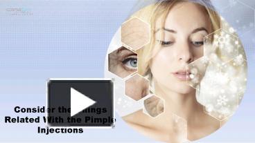 PPT – Consider the Things Related with the Pimple Injections PowerPoint ...