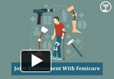 PPT – Knee surgery with femicure PowerPoint presentation | free to ...
