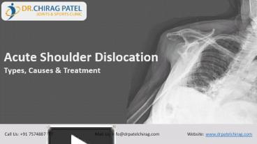PPT – Acute Shoulder Dislocation – Types, Causes & Treatment | Dr ...