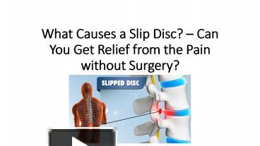 What Causes a Slip Disc Can You Get Relief from the Pain without ...