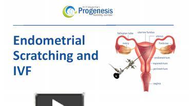 PPT – Endometrial Scratching and IVF PowerPoint presentation | free to ...