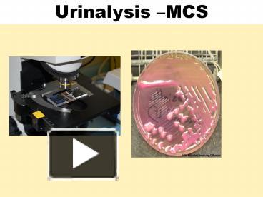 Urinalysis and Urine MCS presentation | free to view