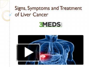 What is Liver Cancer ?Signs, Symptoms and Treatment presentation | free ...