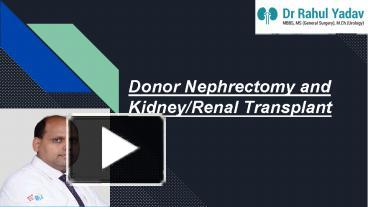 Donor Nephrectomy and Kidney/Renal Transplant presentation | free to ...
