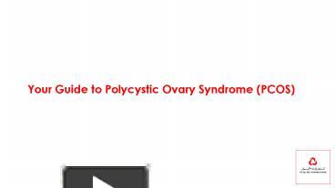 PPT – Your Guide to Polycystic Ovary Syndrome (PCOS) PowerPoint ...