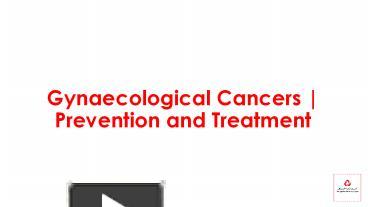 Gynecological Cancers | Prevention and Treatment presentation | free to ...