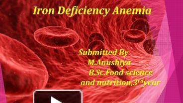 Iron deficiency anemia presentation | free to download
