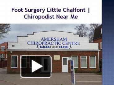 PPT – Foot Surgery Little Chalfont | Chiropodist Near Me PowerPoint ...