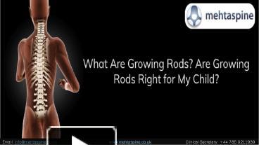 Growing Rods for Scoliosis in Children | Children Spine Specialist in ...