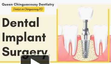 PPT – Dental Implant Surgery: What Is It? PowerPoint presentation ...