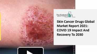 Global Skin Cancer Drugs Market Opportunities And Strategies To 2030 ...
