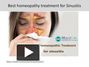 PPT – 6 Best homeopathic Medicines for Sinusitis Treatment. PowerPoint ...