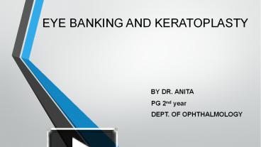 Eye banking &Keratoplasty presentation | free to download